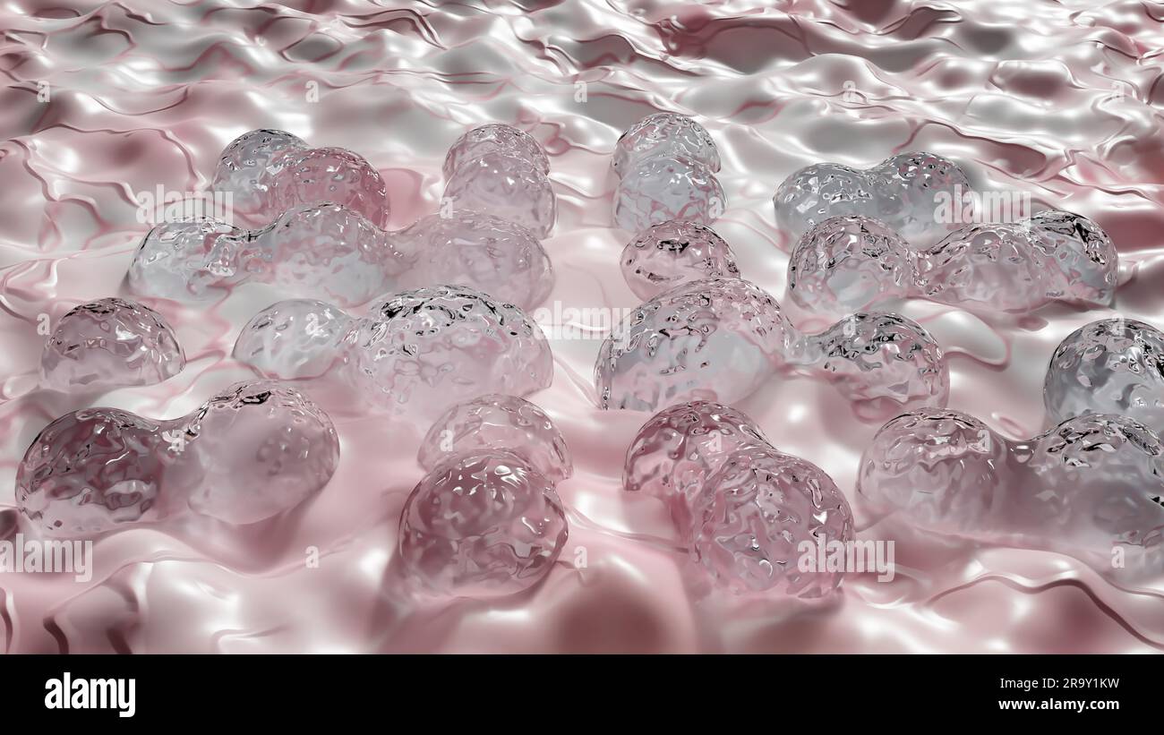 Cancer cell growth uncontrollably over tissue, Tumor infection cells ...