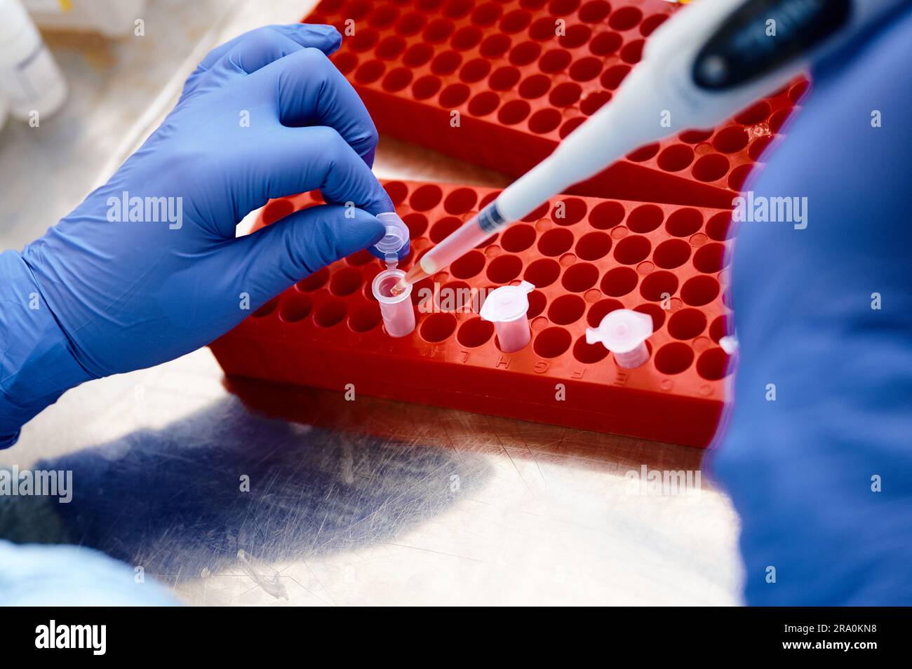Bacterial identification tube hi-res stock photography and images - Alamy
