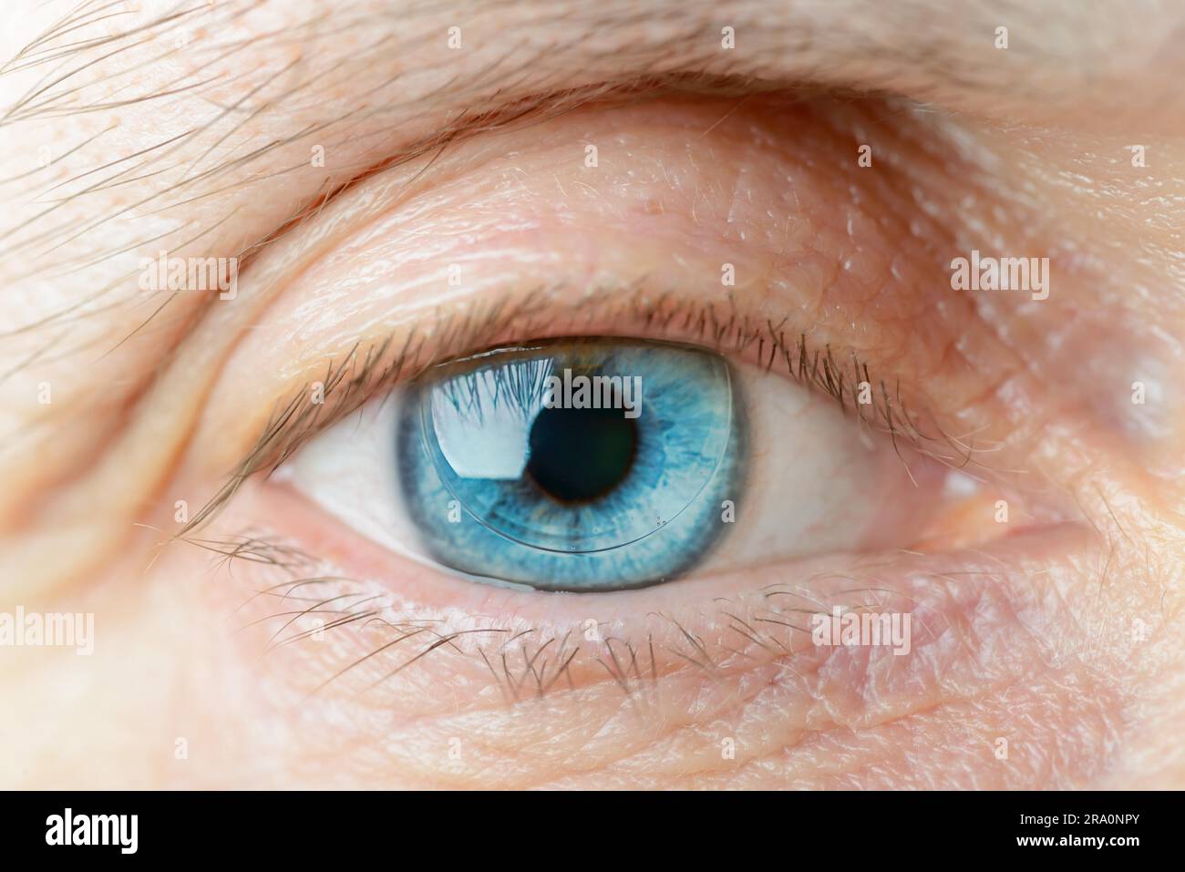 Macro of a hard contact lens on woman's blue eye Stock Photo - Alamy