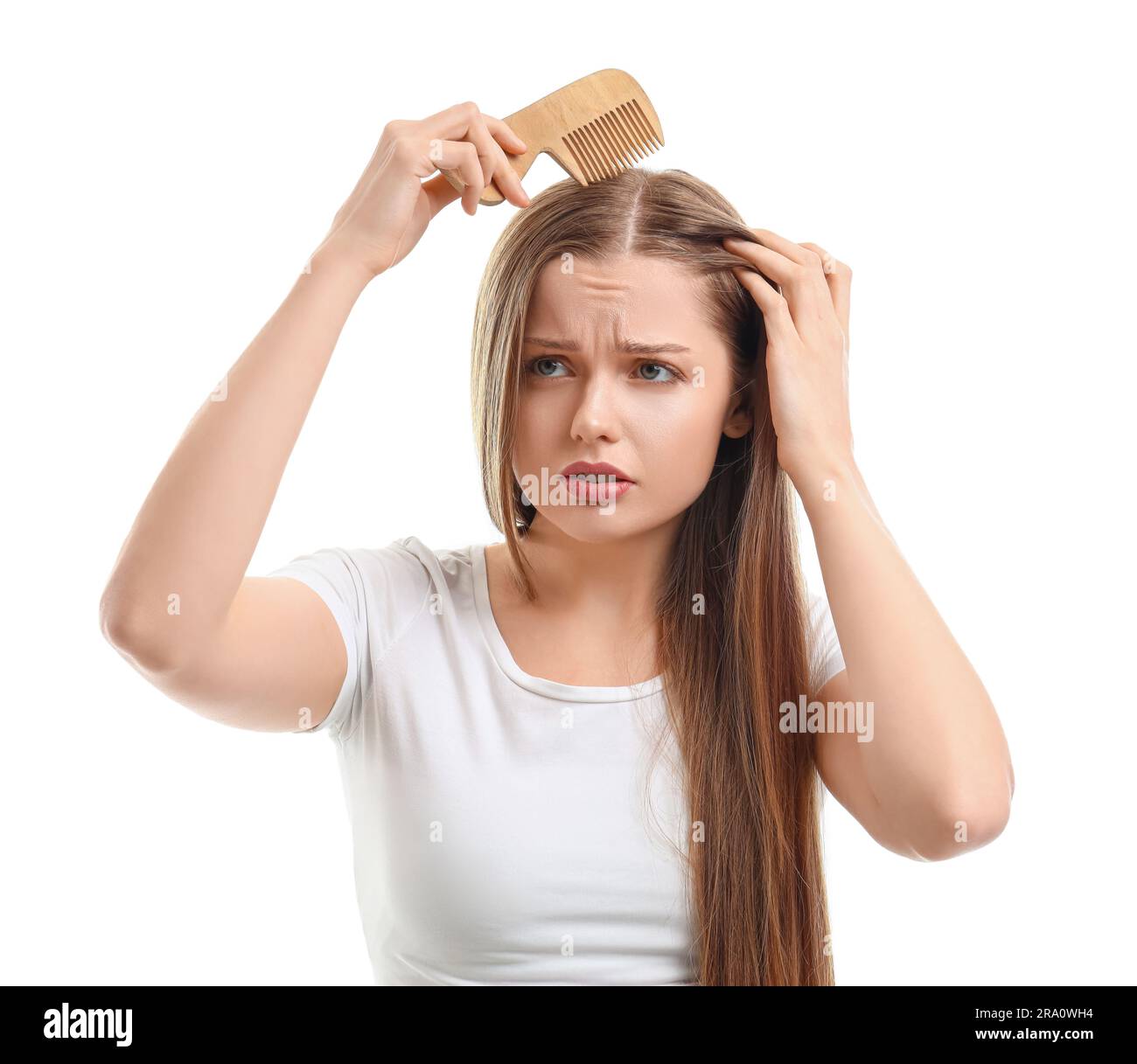 Worried young woman with hair loss problem on white background Stock ...