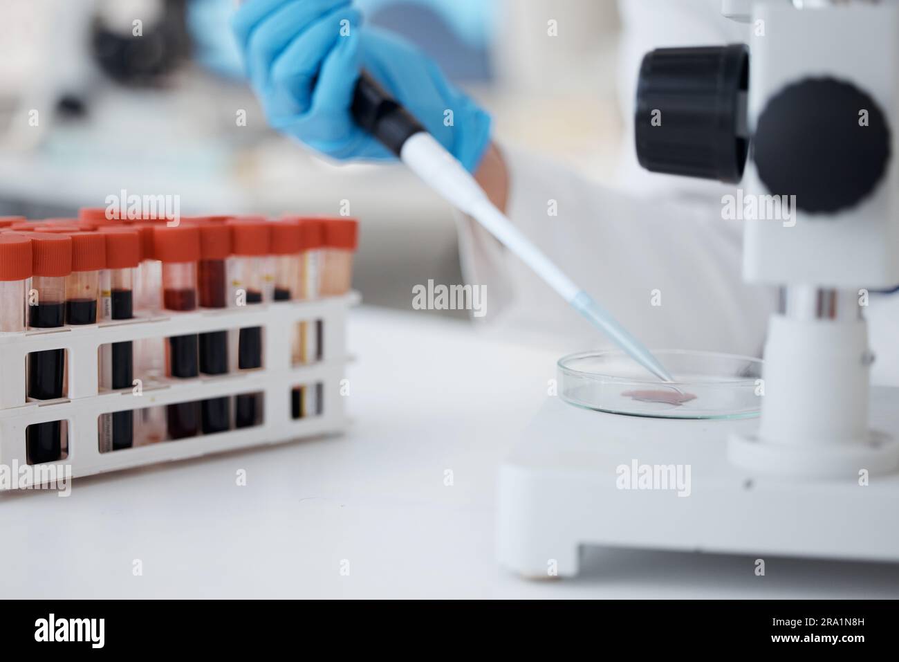 Hands, pipette and scientist with blood petri dish for research in ...