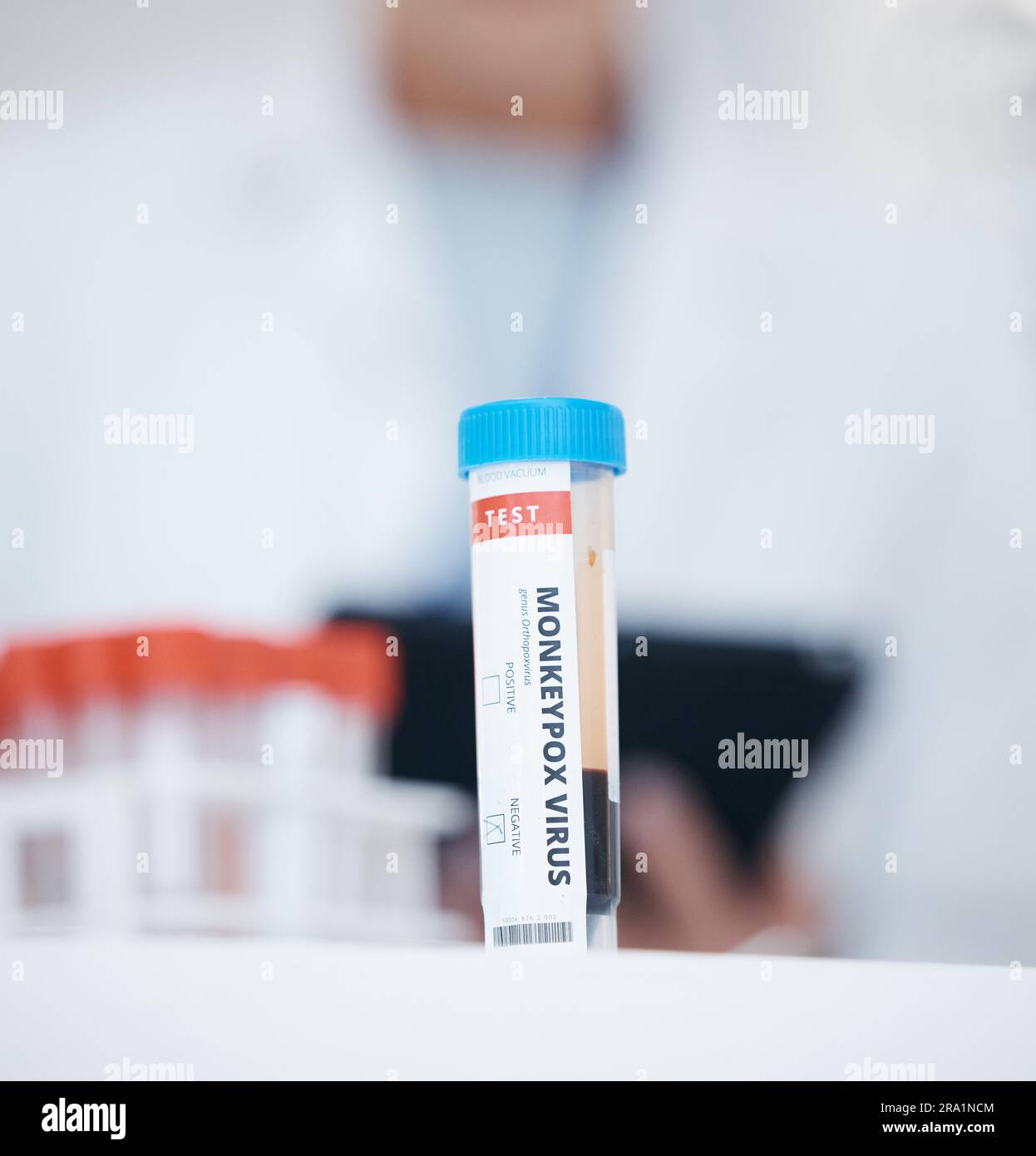 Blood test, sample of virus and science in laboratory, research and ...