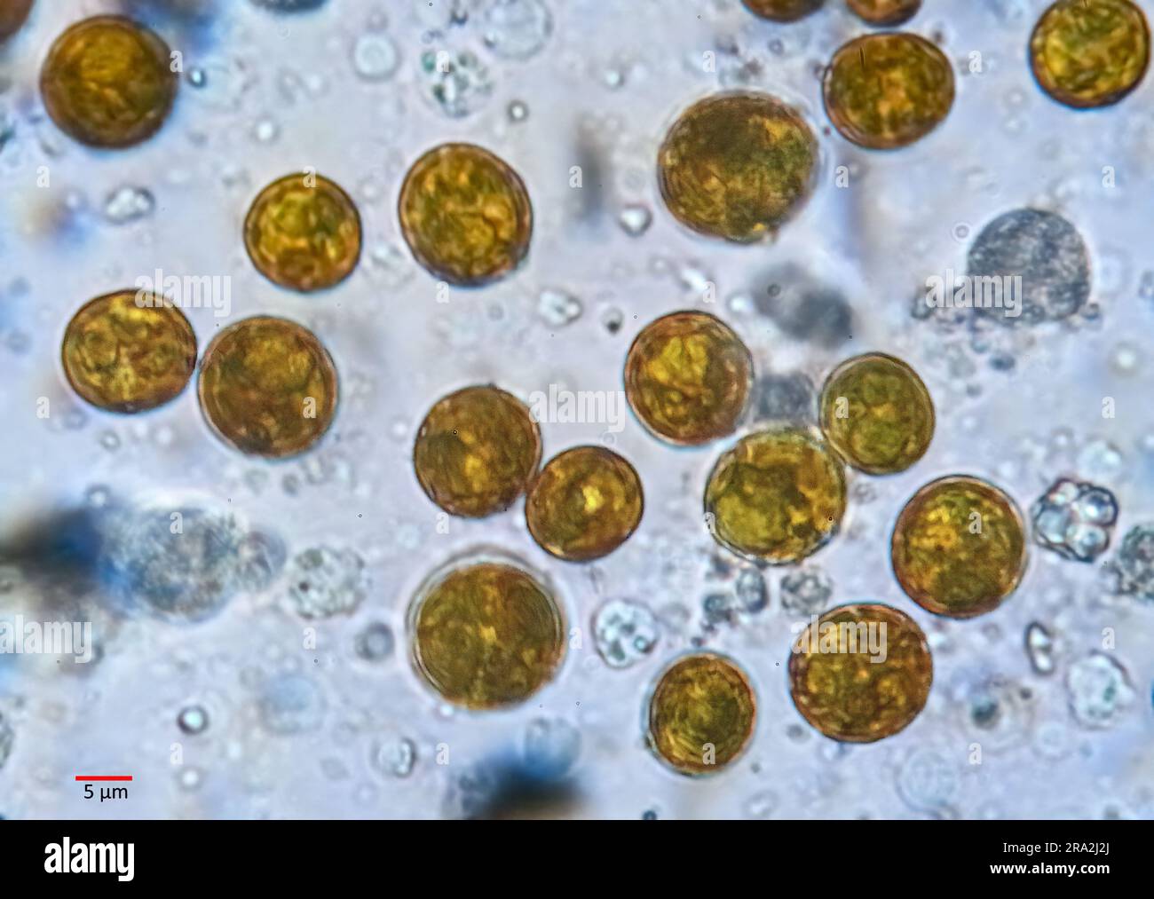 Zooxanthellae from a soft coral (probably Sinularia sp.). The ...