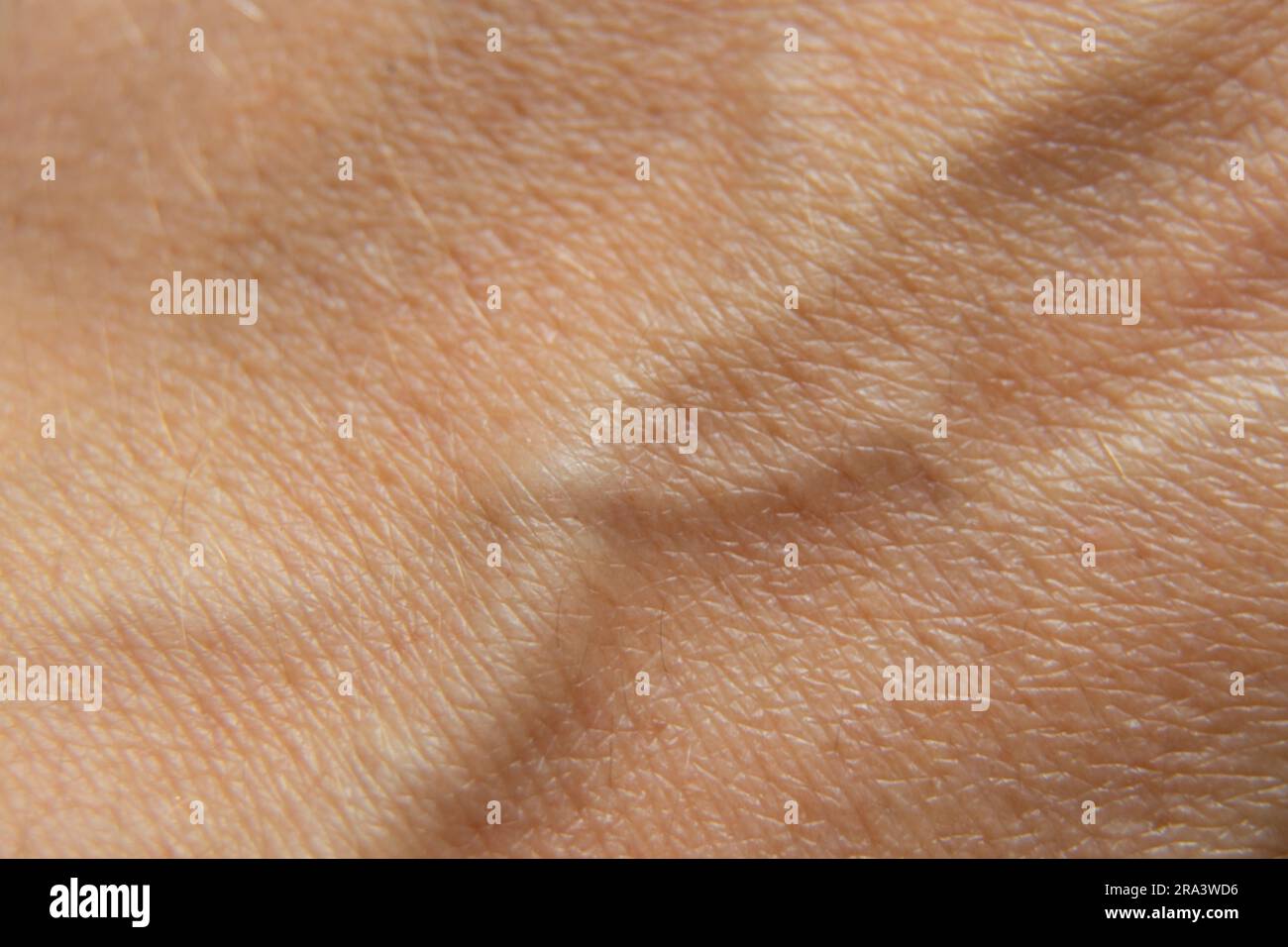 bulging vein on human hand as background close up Stock Photo - Alamy