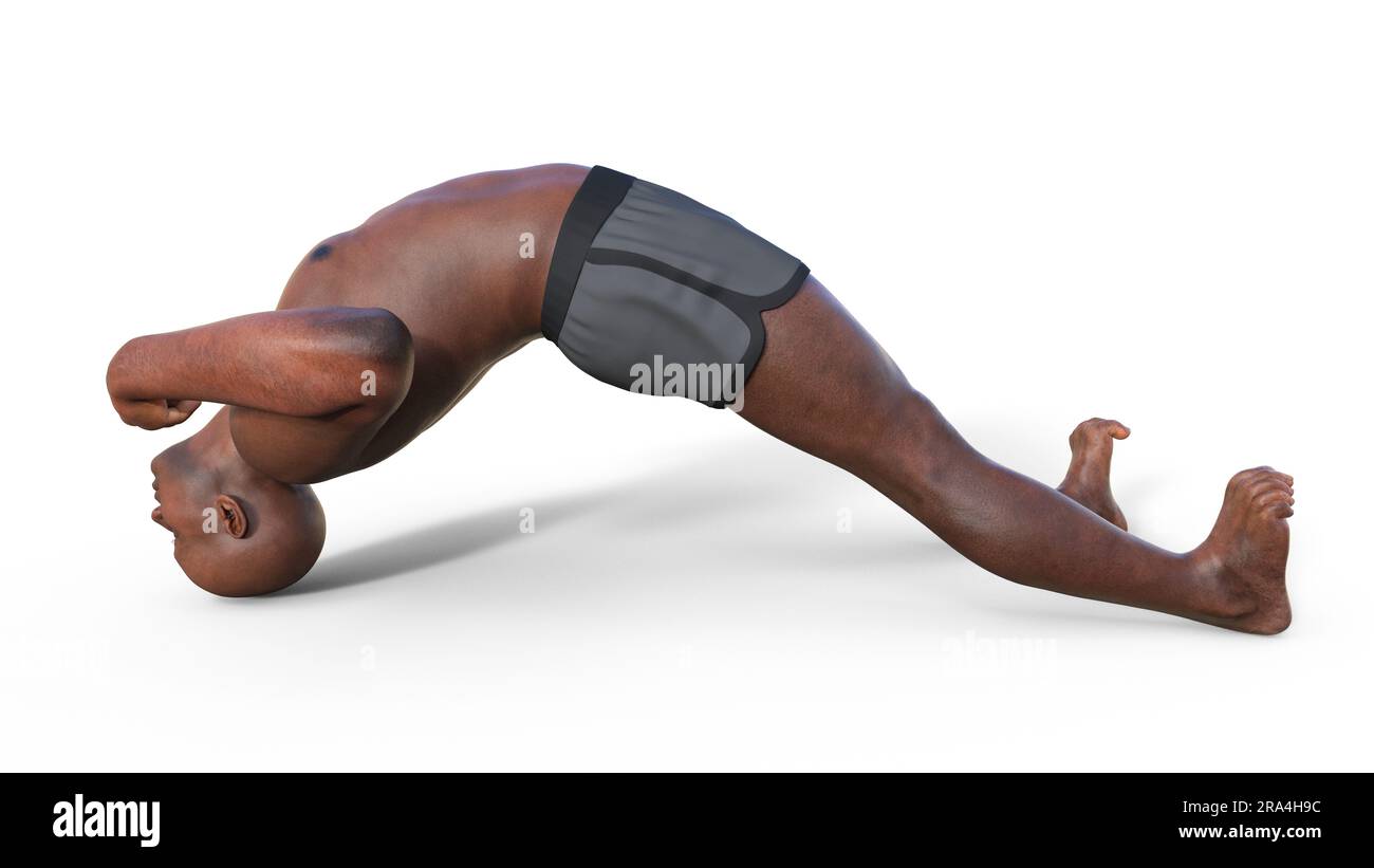 Opisthotonus in tetanus, illustration Stock Photo - Alamy