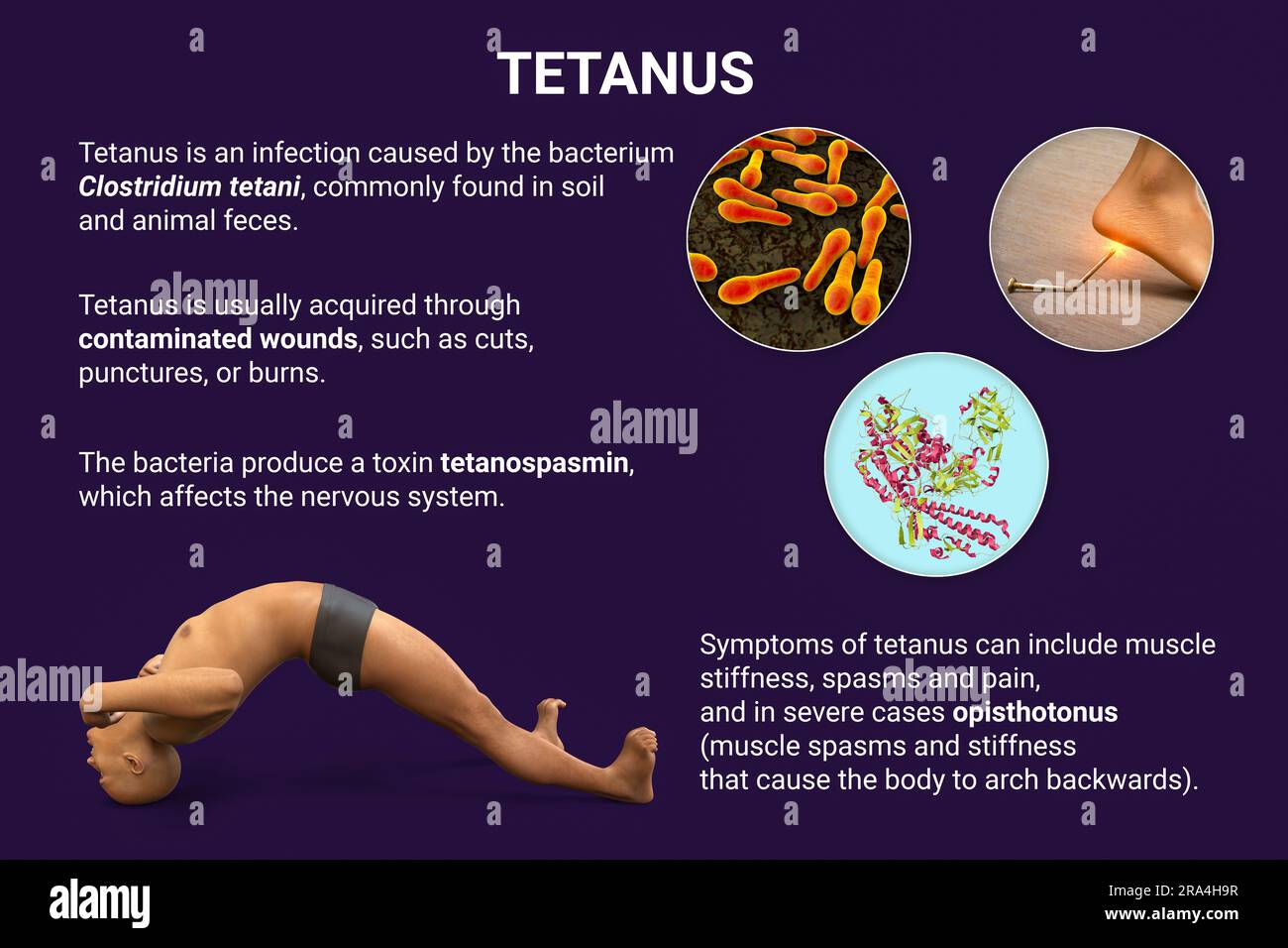 Neurotropic hi-res stock photography and images - Alamy