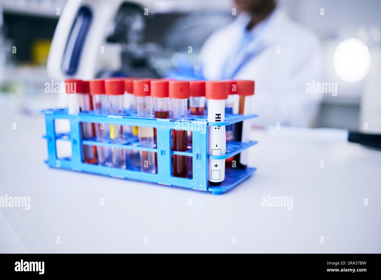 Medical, research and vials with blood test, science and breakthrough ...