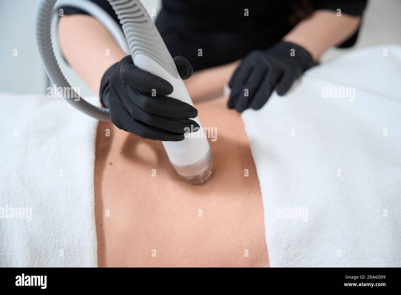 Effective RF lifting procedure for the abdominal area Stock Photo - Alamy