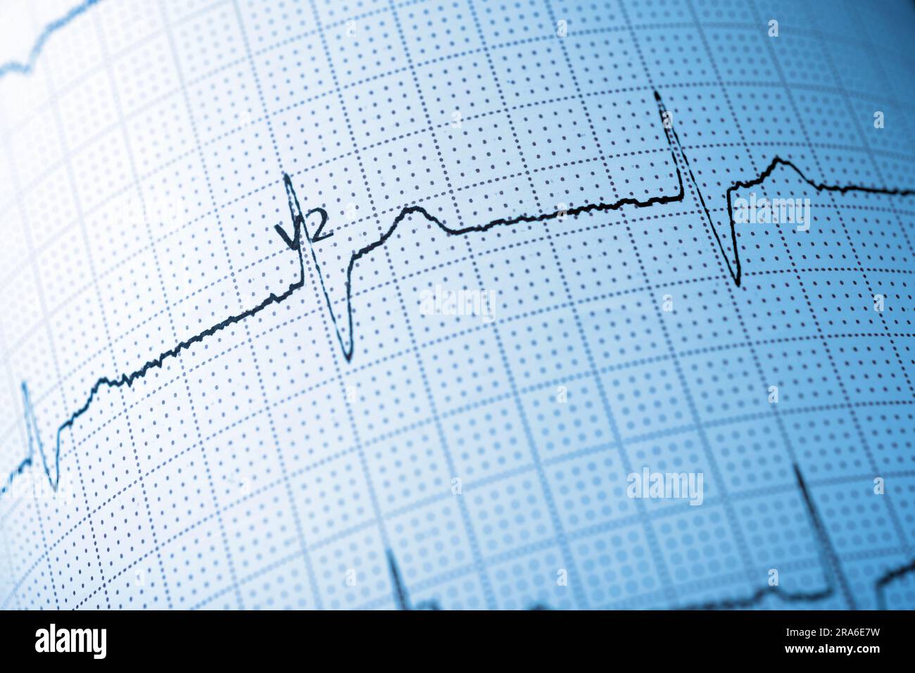 Electrocardiogram showing the pulse of the human heart Stock Photo - Alamy