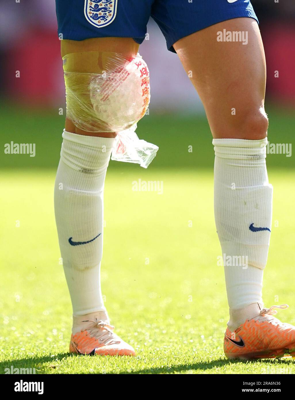 Close up of an ice pack on England's Chloe Kelly's right leg after the ...