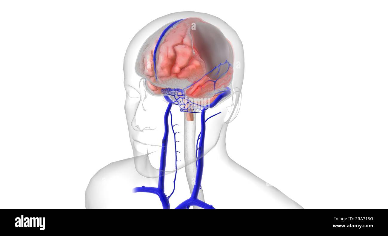 Subdural hematoma dura brain hi-res stock photography and images - Alamy