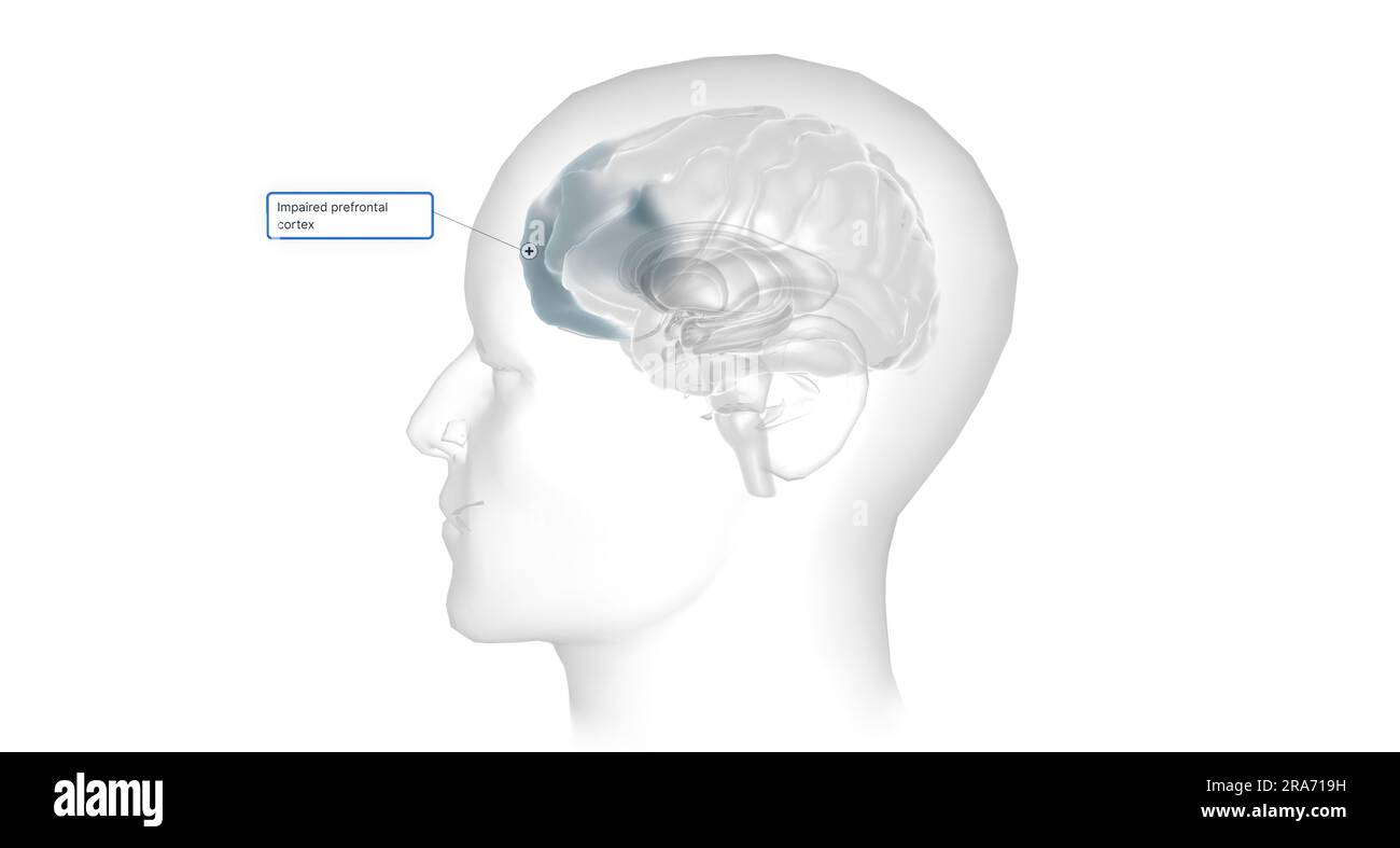 Prefrontal cortex. hi-res stock photography and images - Alamy