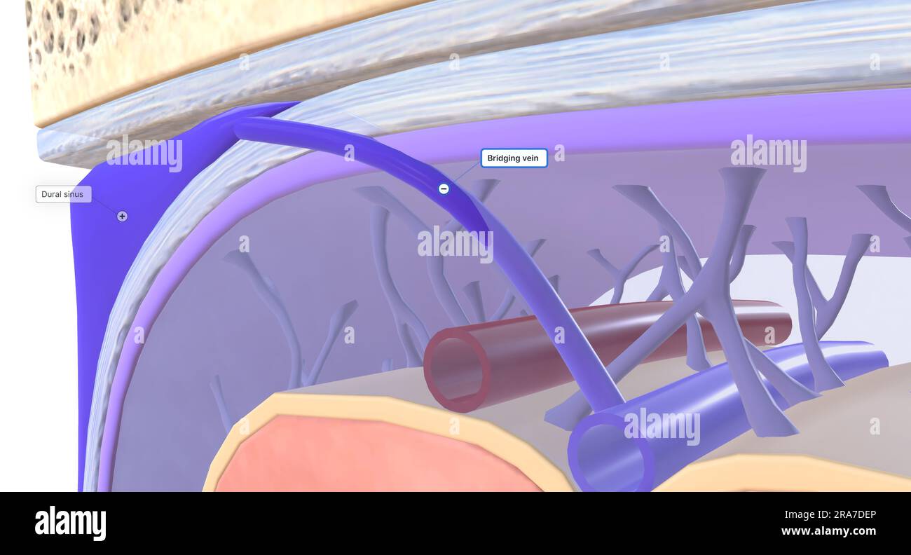 Renal aneurysms hi-res stock photography and images - Alamy