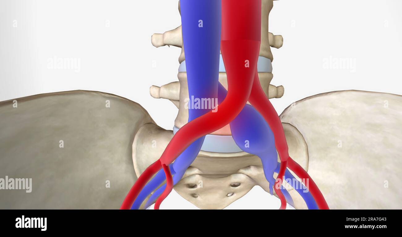 Iliac artery hi-res stock photography and images - Alamy