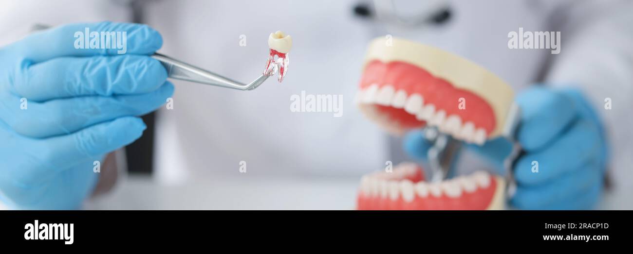 Dentist holding tooth with tweezers and showing jaw model Stock Photo ...