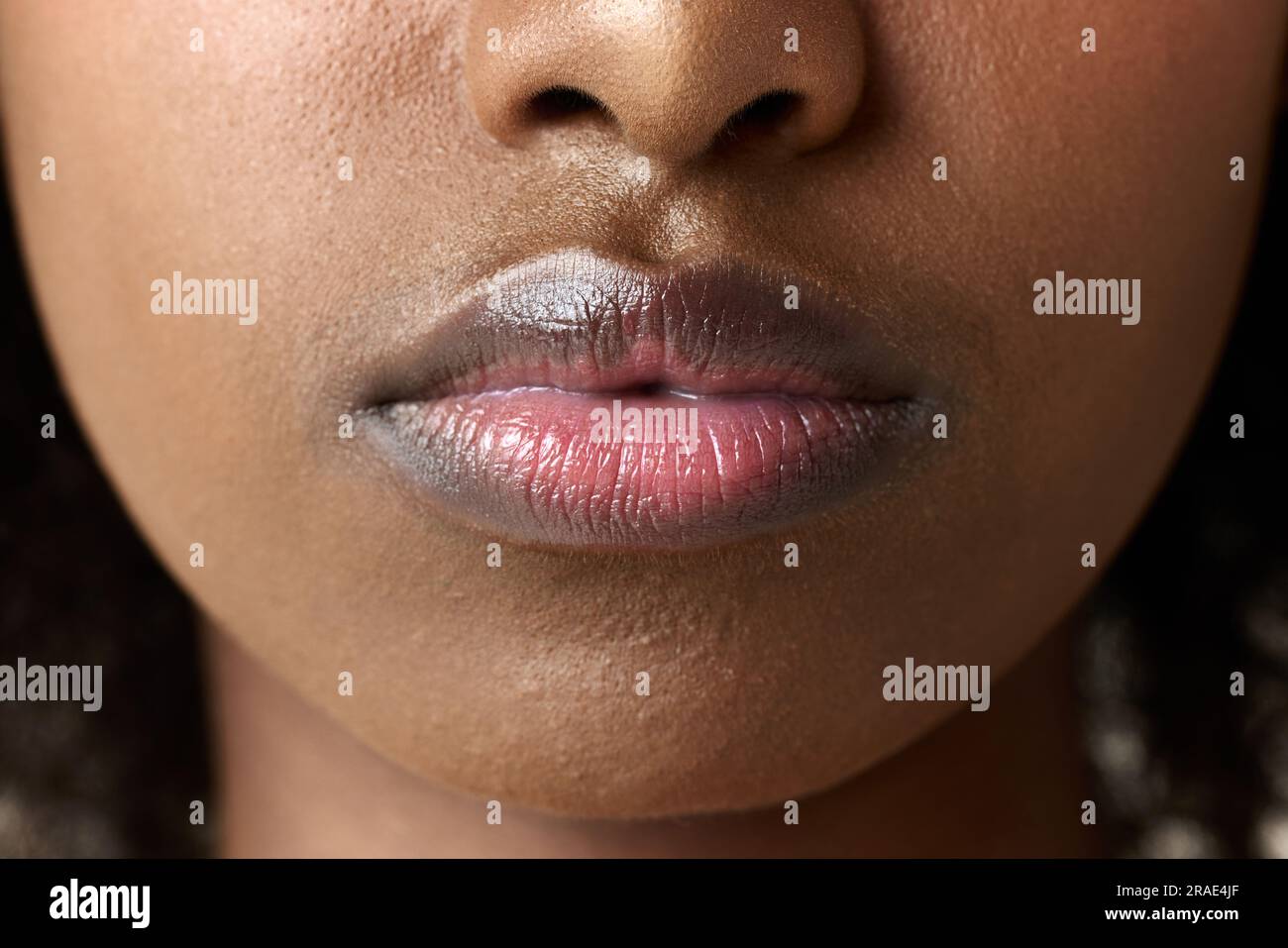 Close-up image of young african woman, female lips. Lip augmentation ...