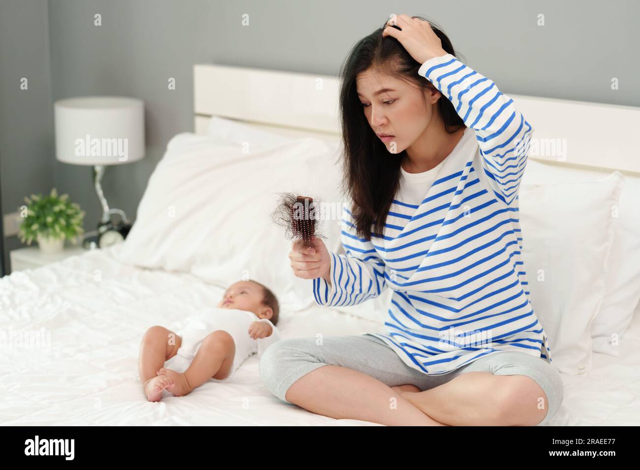 stressed mother having hair loss postpartum problem with her baby at ...