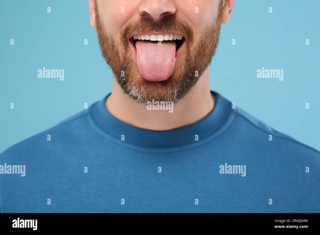 Blue tongue disease hi-res stock photography and images - Alamy