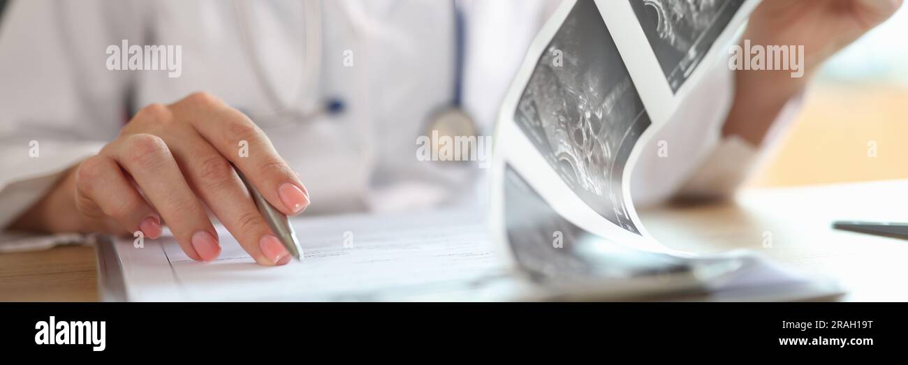 Female doctor looking at description of ultrasound shots of patient ...
