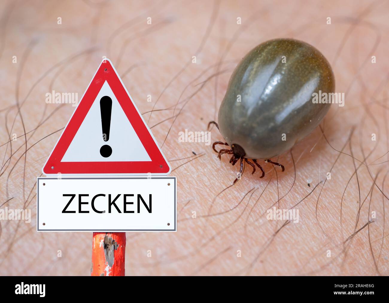 Bloody parasite hi-res stock photography and images - Alamy