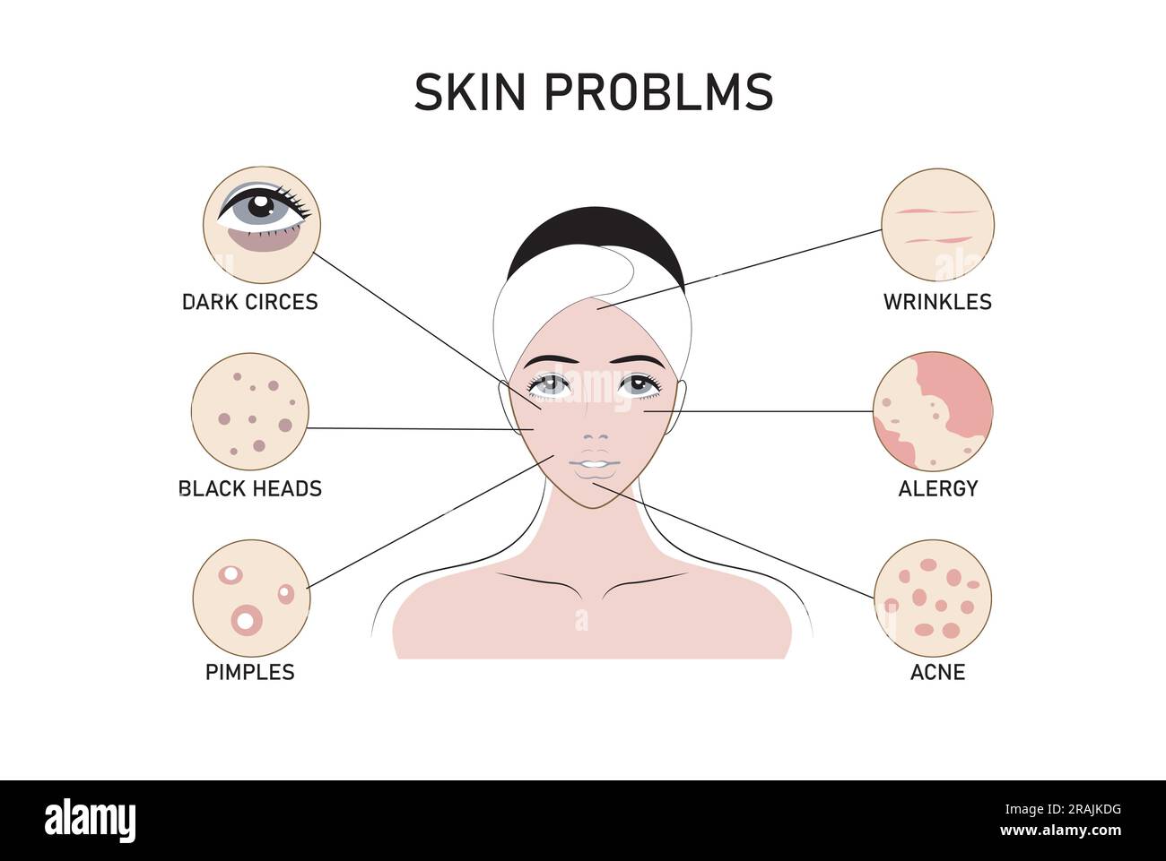 Skin Problems. Acne, Dark circles, Black Heads, Pimple, Allergy ...