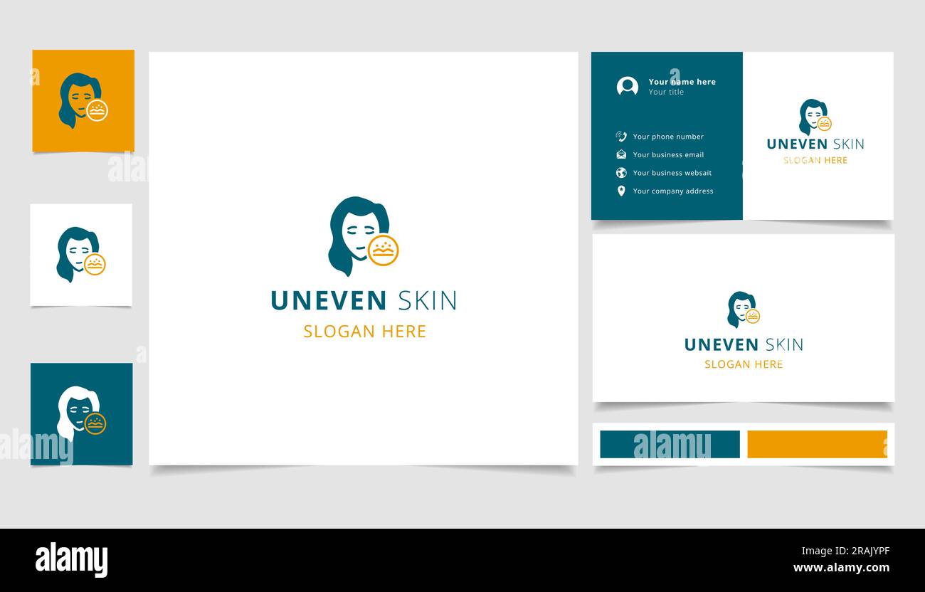 Uneven skin logo design with editable slogan. Branding book and ...