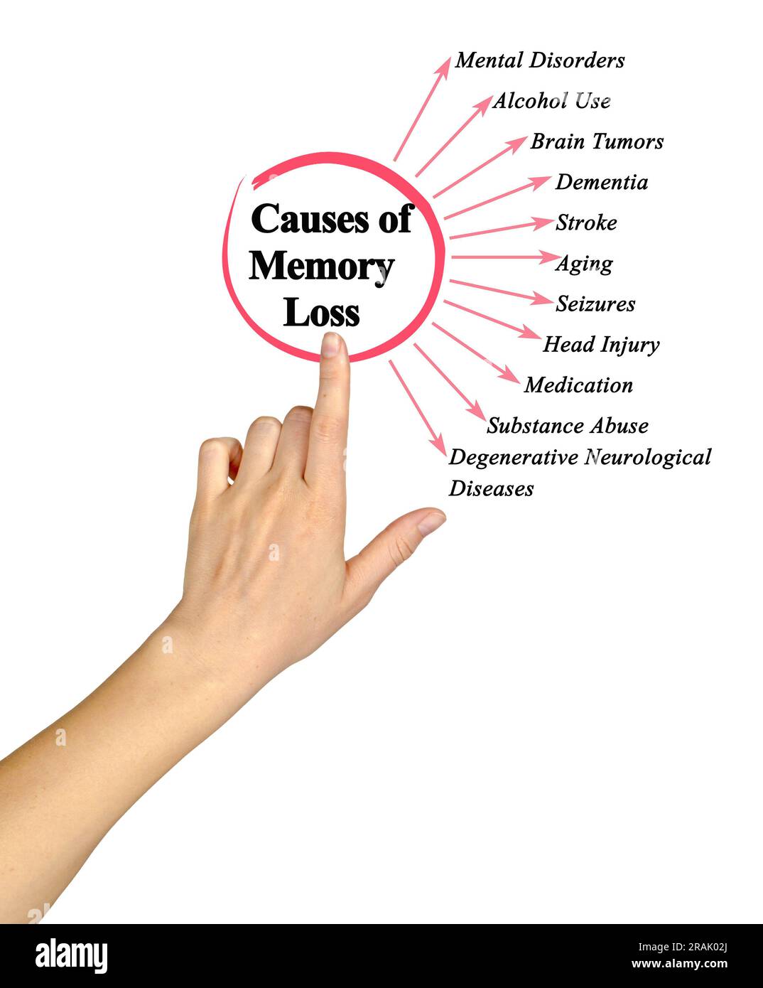 Causes of stroke hi-res stock photography and images - Alamy
