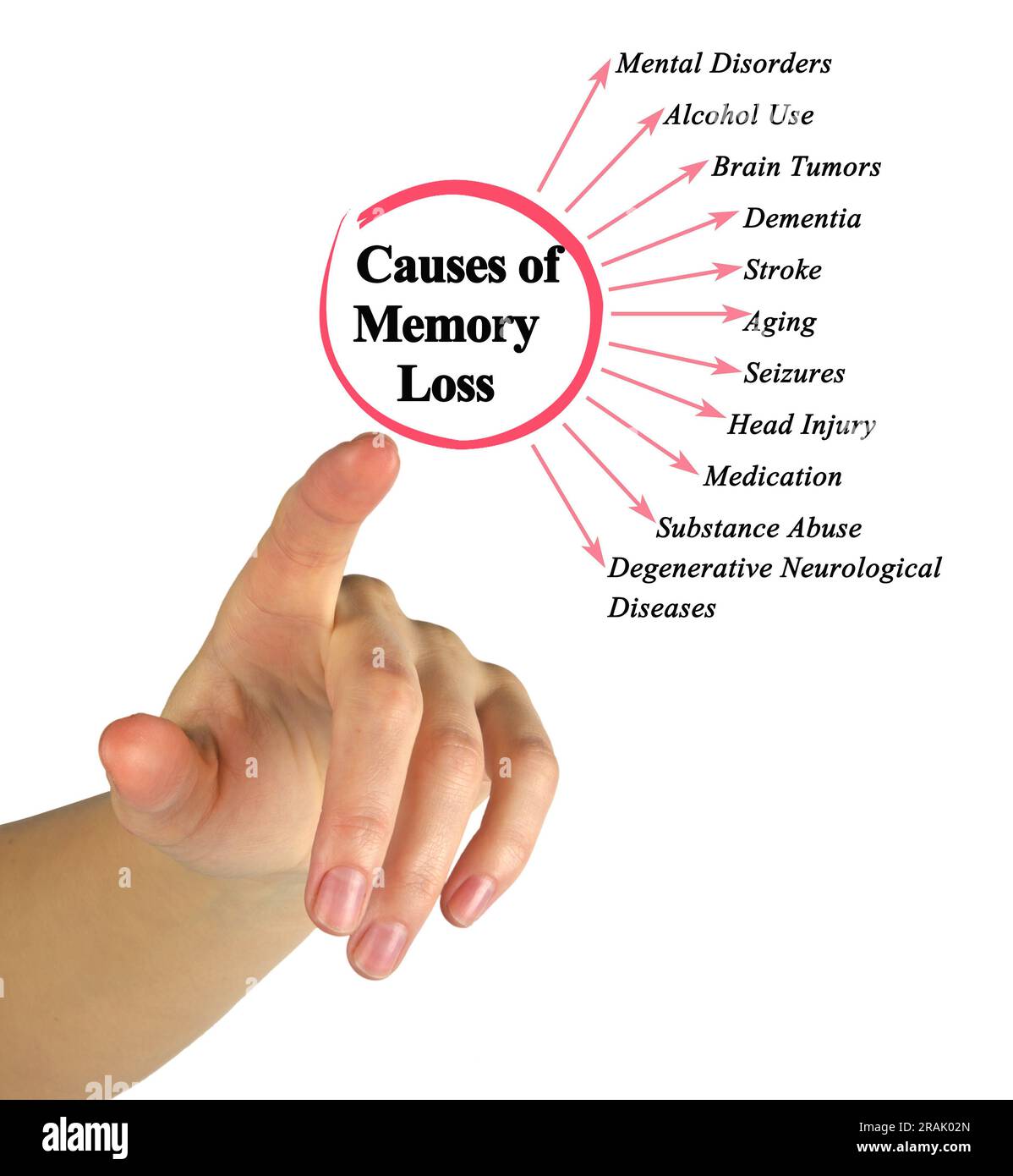 Degenerative brain diseases hi-res stock photography and images - Alamy