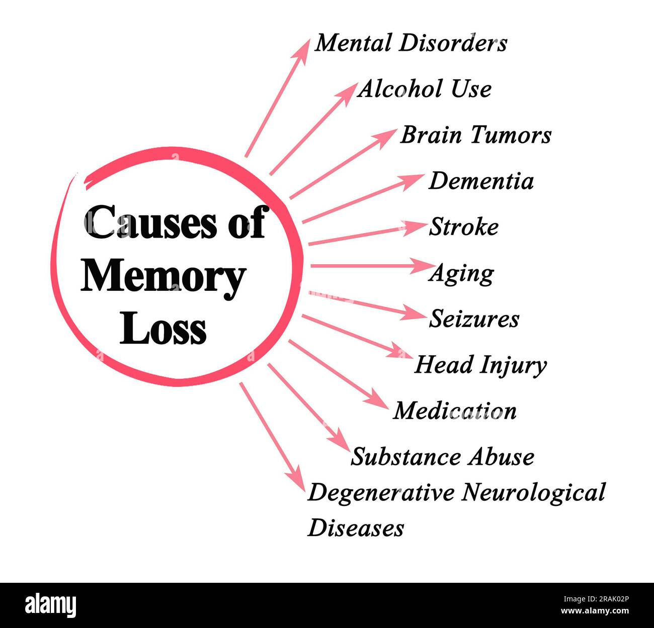 Causes of stroke hi-res stock photography and images - Alamy