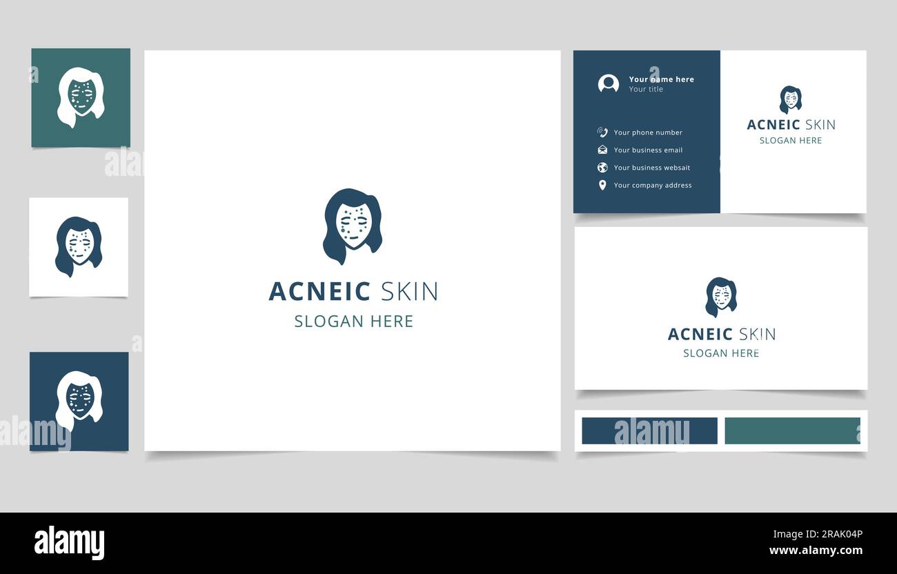 Acneic skin logo design with editable slogan. Branding book and ...
