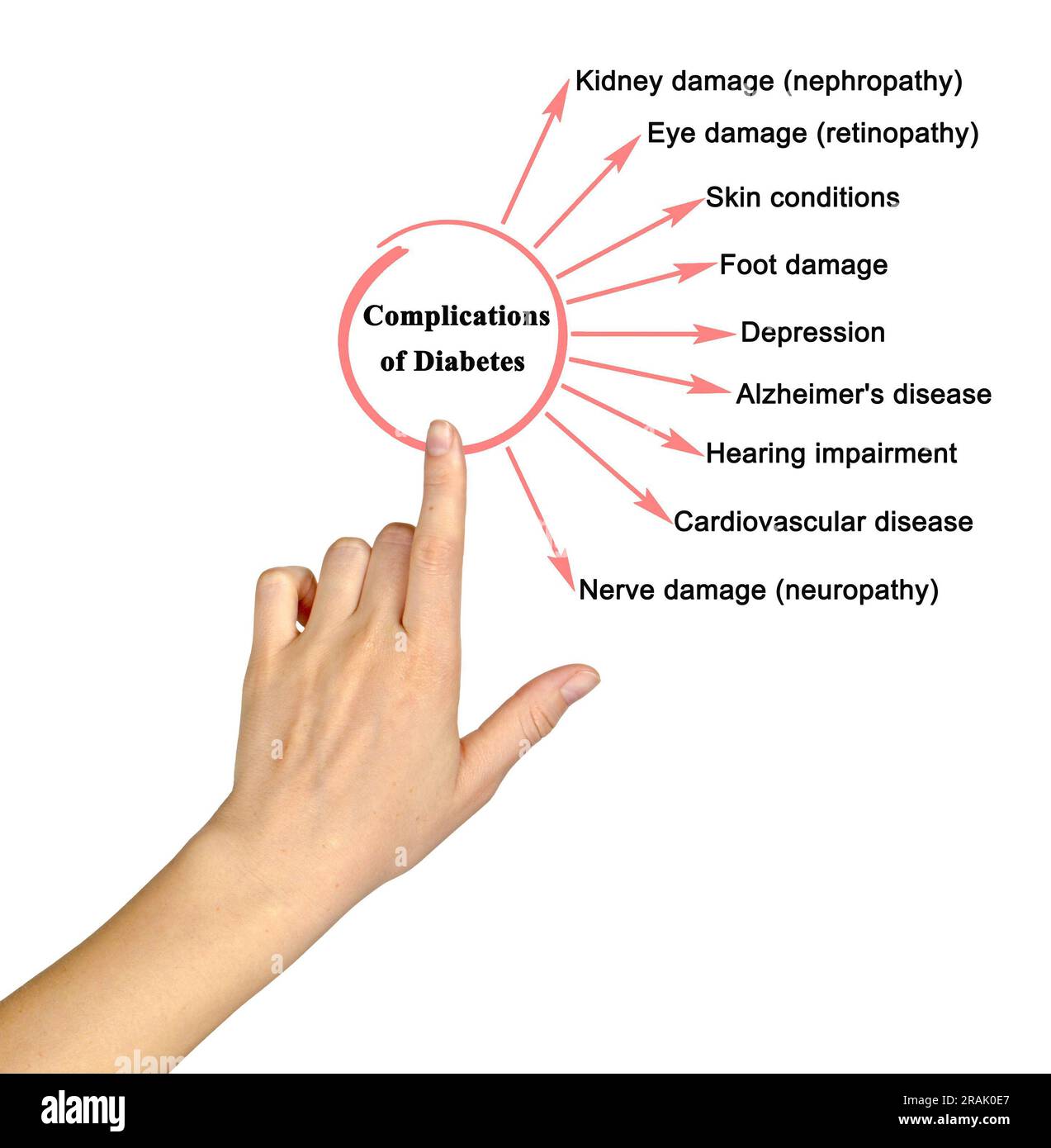 Presenting Nine Complications of Diabetes Stock Photo - Alamy