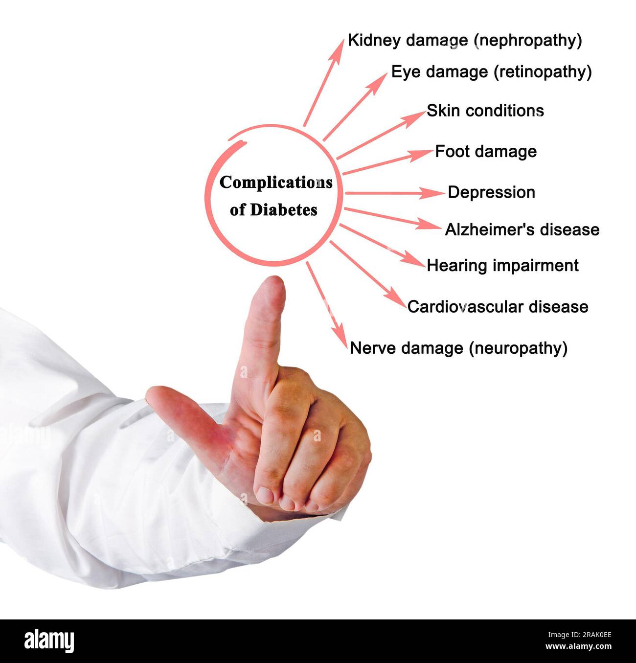 Presenting Nine Complications of Diabetes Stock Photo - Alamy