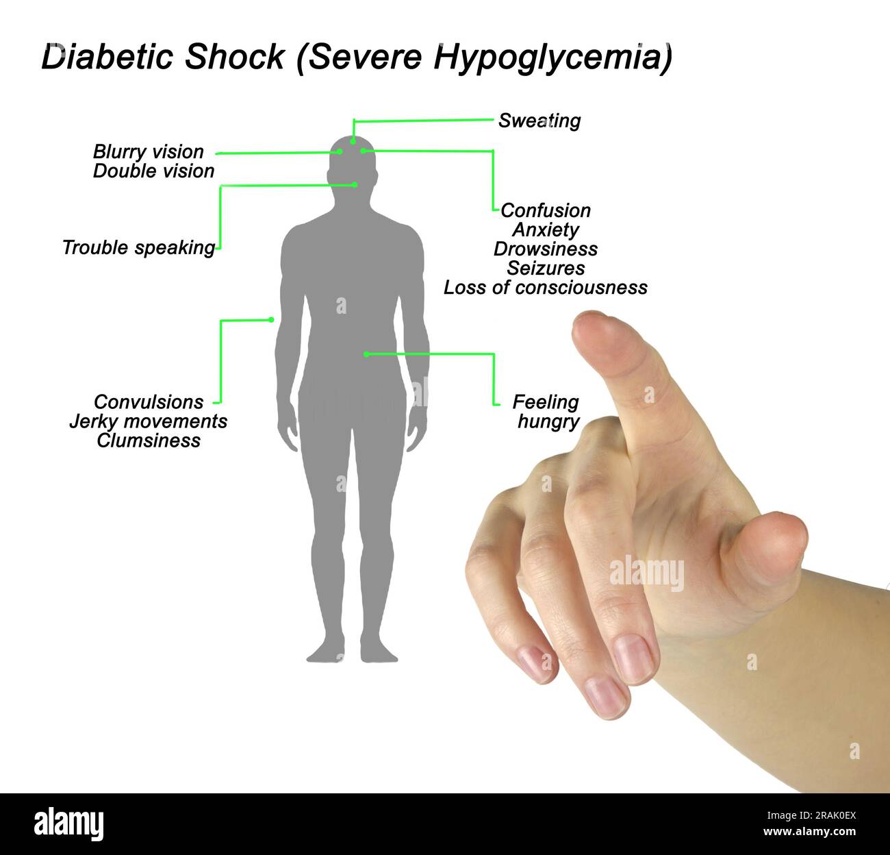 Diabetic Shock (Severe Hypoglycemia Stock Photo - Alamy