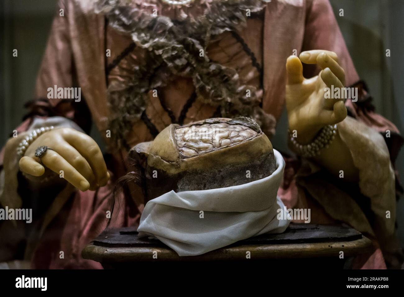 Anatomical Wax Models at James Winkel blog