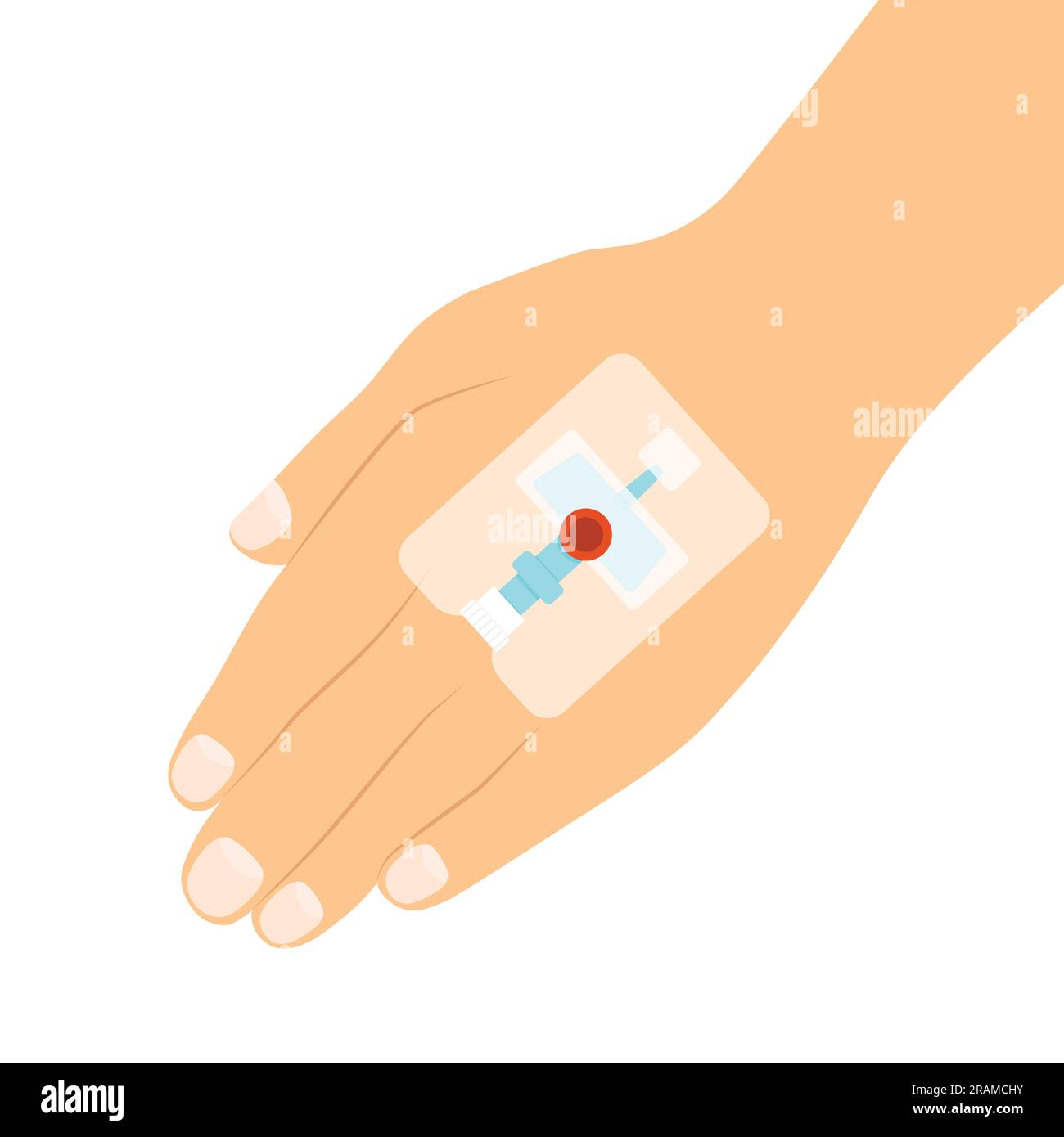 Intravenous catheter Stock Vector Images - Alamy