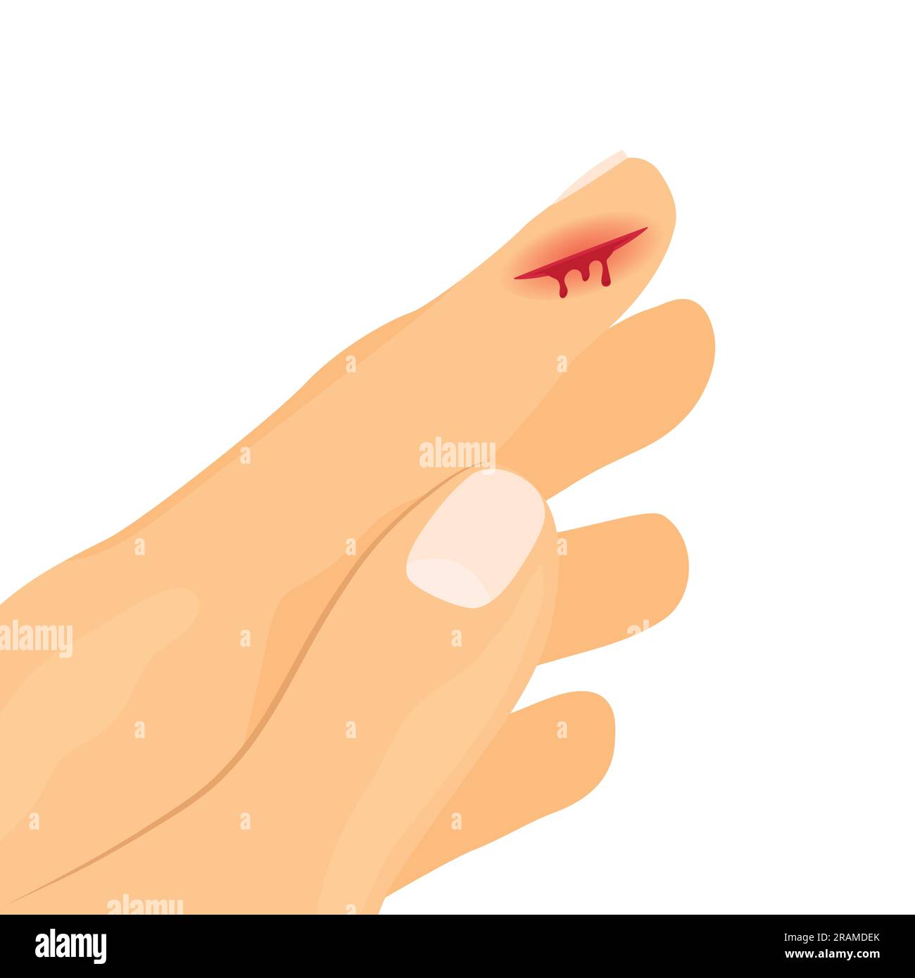Finger trauma vector vectors hi-res stock photography and images - Alamy