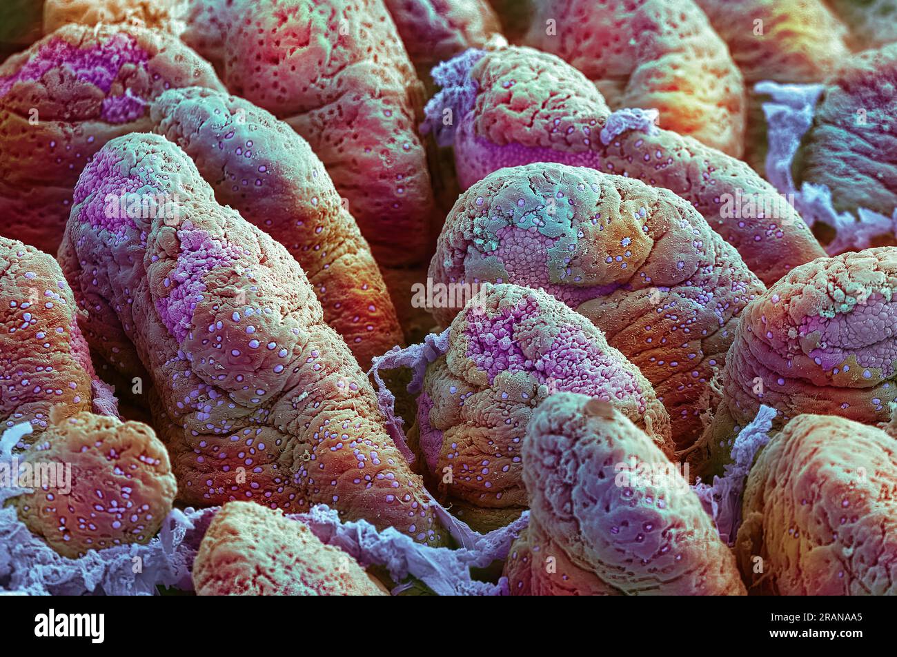 Small intestine, SEM Stock Photo - Alamy
