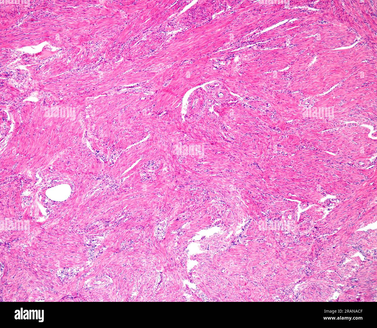 Myometrium, light micrograph Stock Photo - Alamy