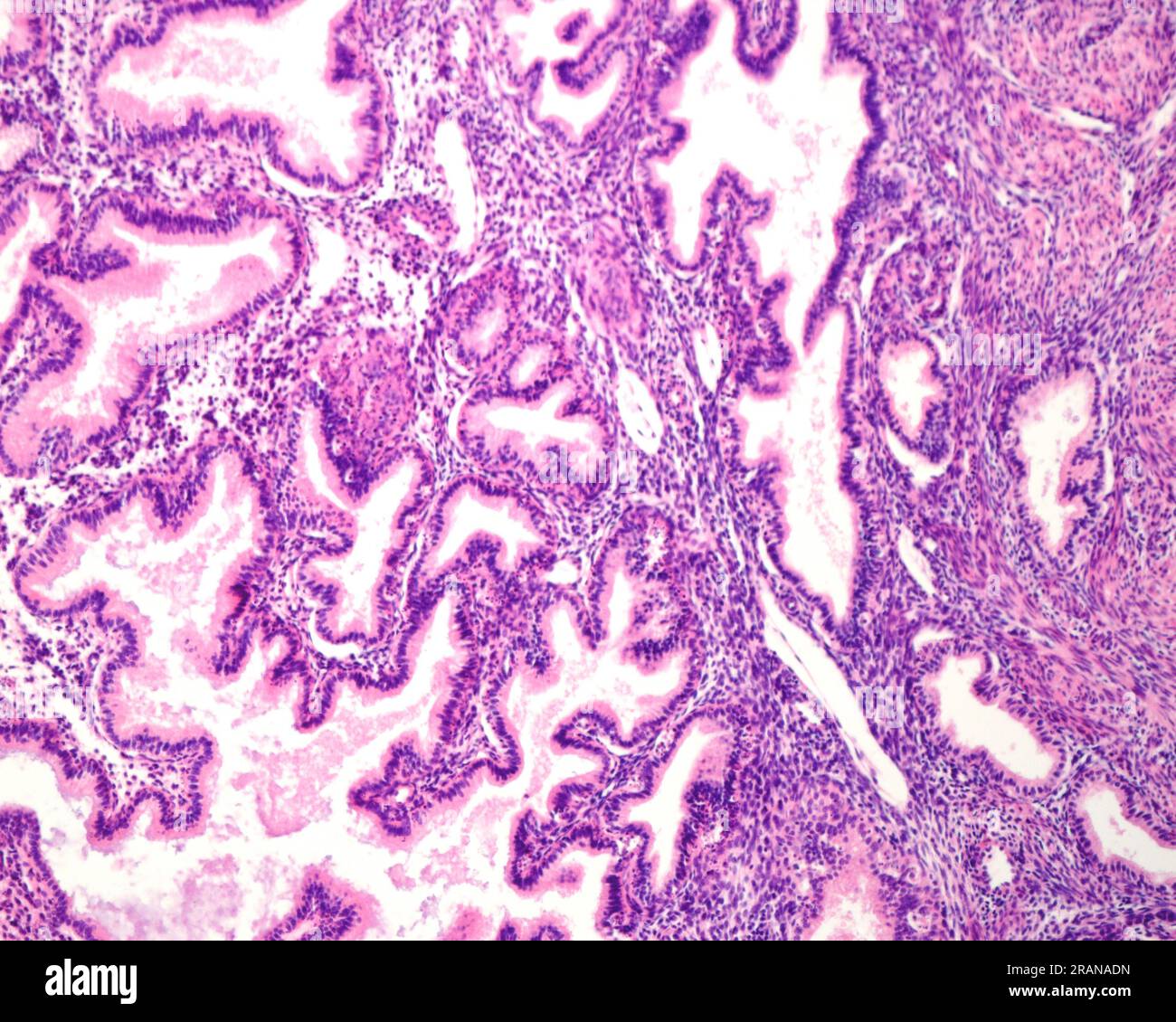 Human endometrium in secretory phase, light micrograph Stock Photo - Alamy