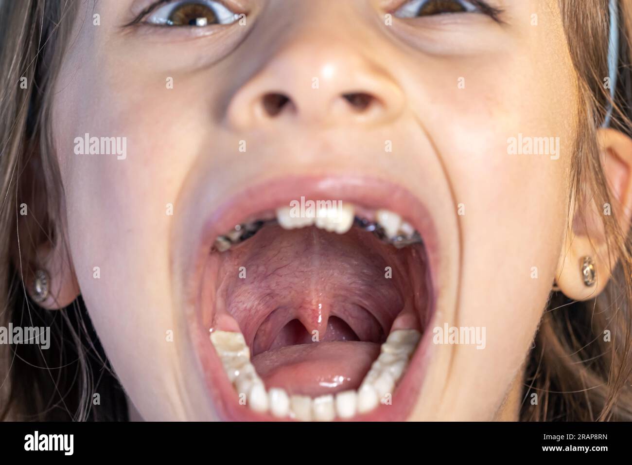 Child during orthodontist visit and oral cavity check-up Stock Photo ...