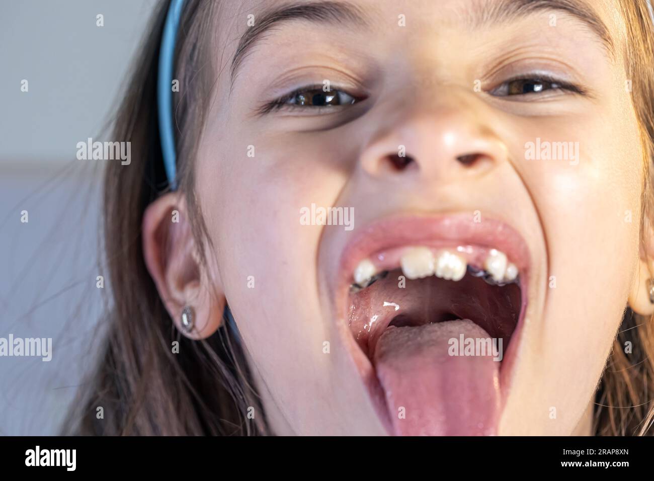 Child during orthodontist visit and oral cavity check-up Stock Photo ...