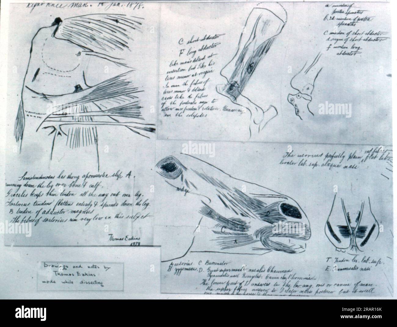 Anatomical realism hi-res stock photography and images - Alamy
