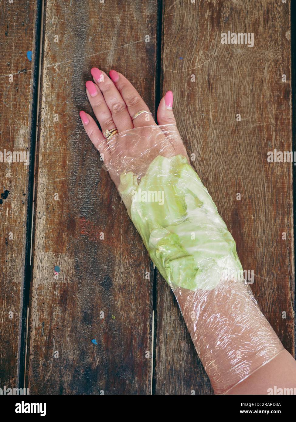 woman wrist wrapped in cabbage leaves compress for anti inflammatory ...