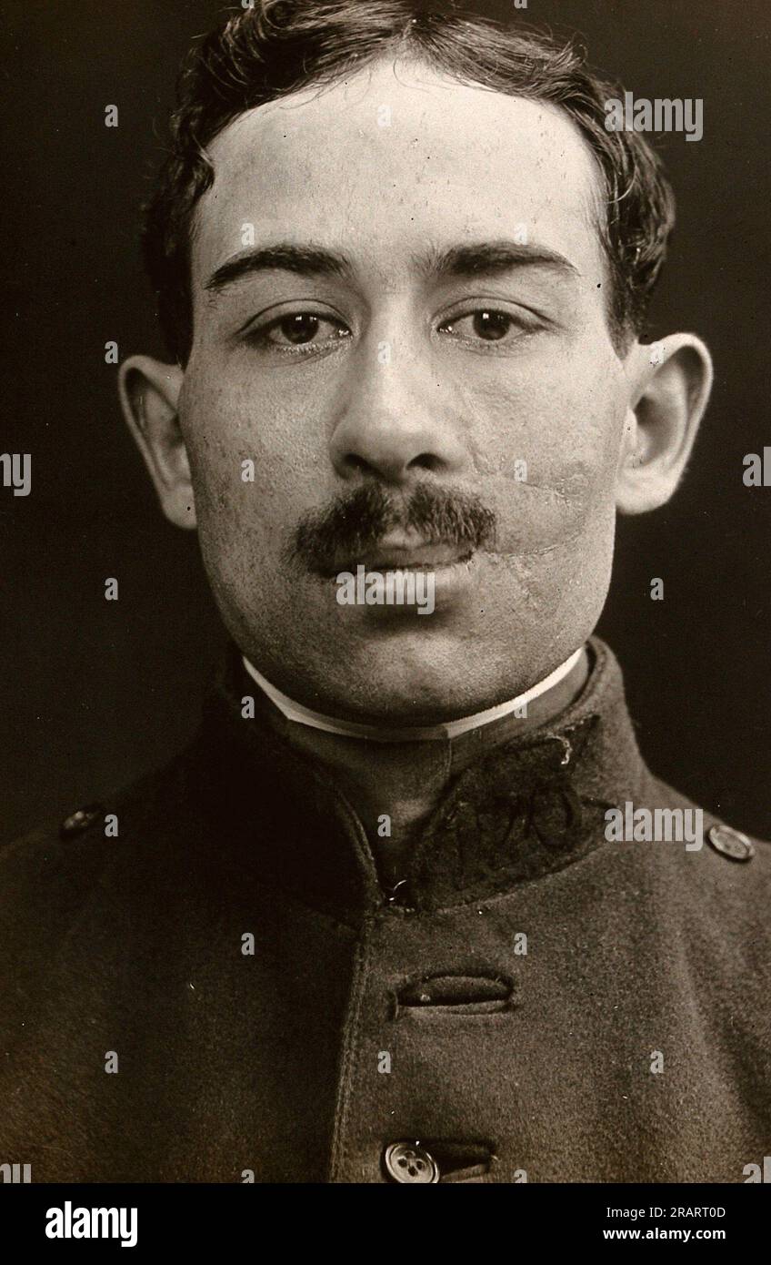 Soldier injury hi-res stock photography and images - Alamy