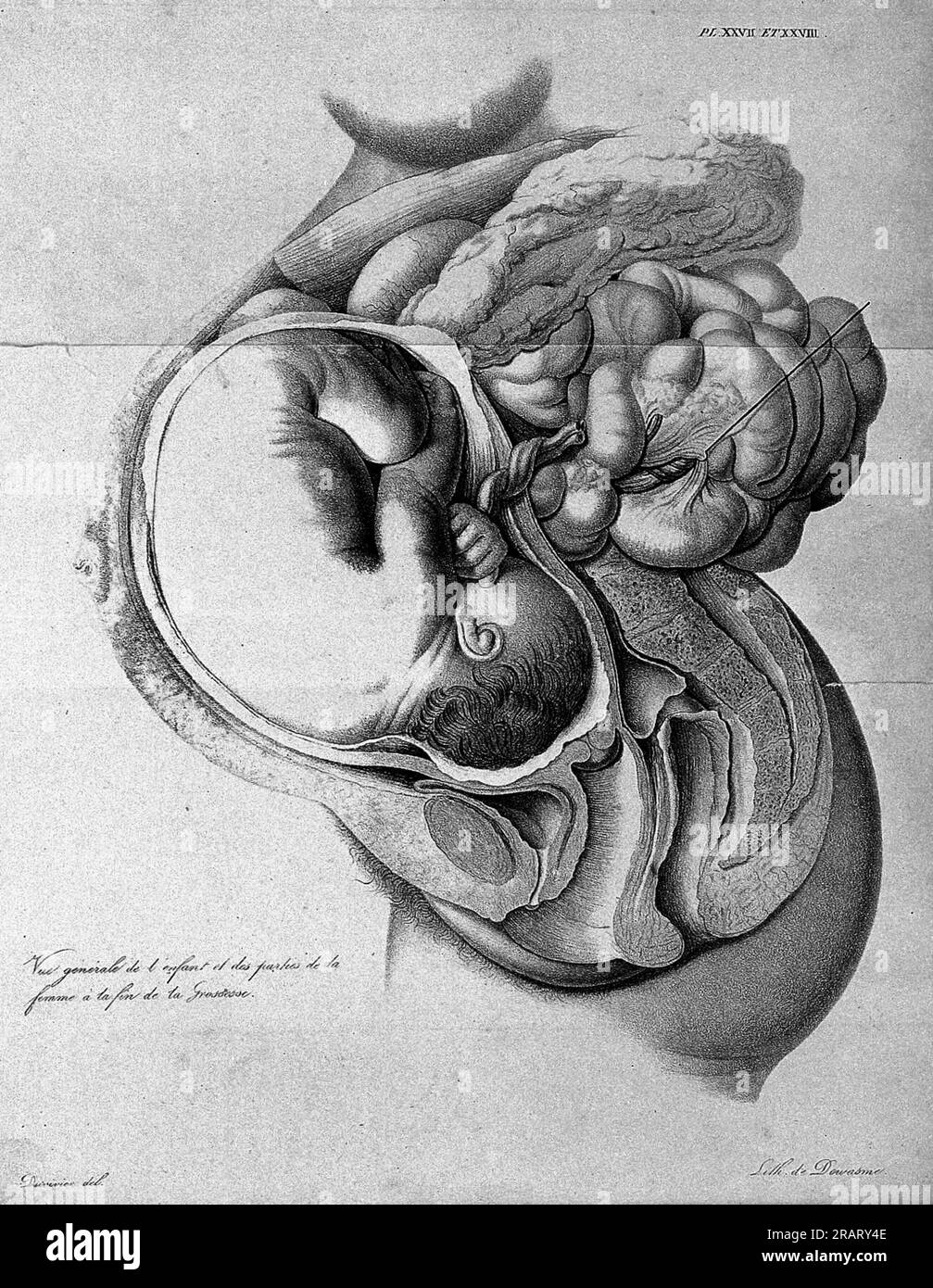 Fetus birth hi-res stock photography and images - Alamy