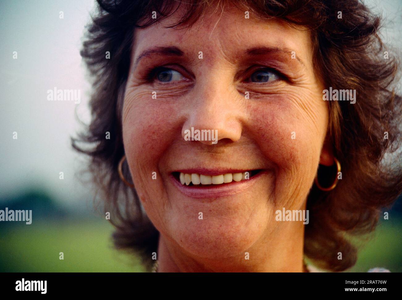 Female Early 50's with Poor Skin Stock Photo - Alamy