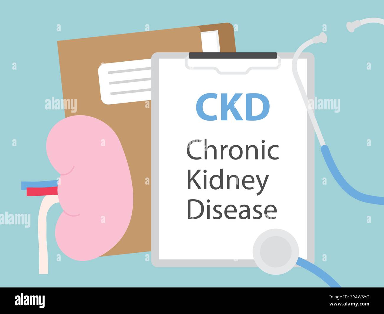 CKD Chronic Kidney Disease concept- vector illustration Stock Vector ...