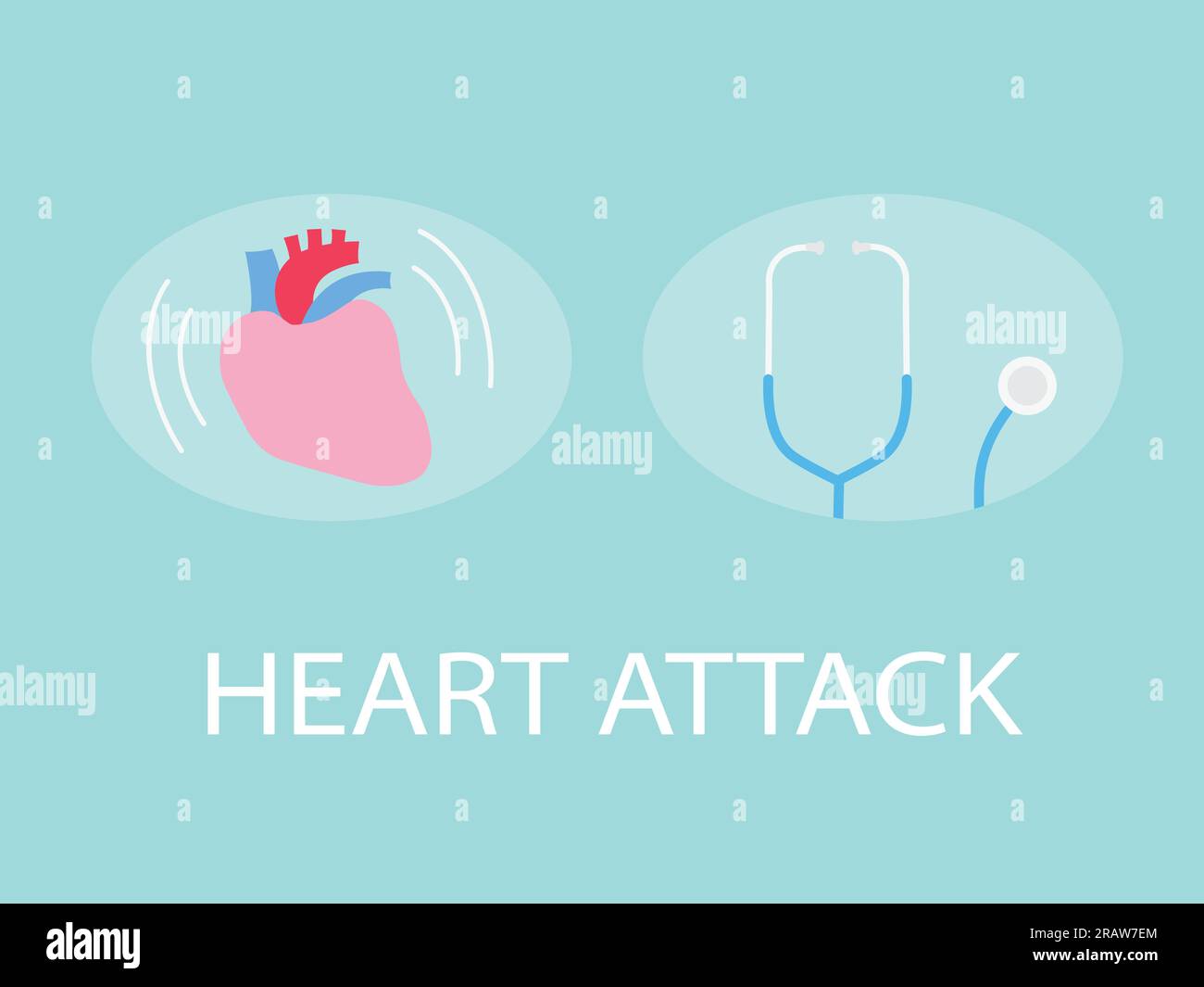 Heart attack concept, heart and stehoscope icon - vector illustration ...
