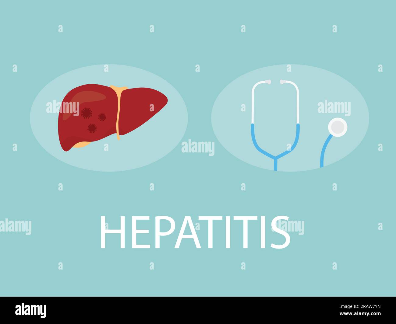 concept of Hepatitis virus, liver disease- vector illustration Stock ...