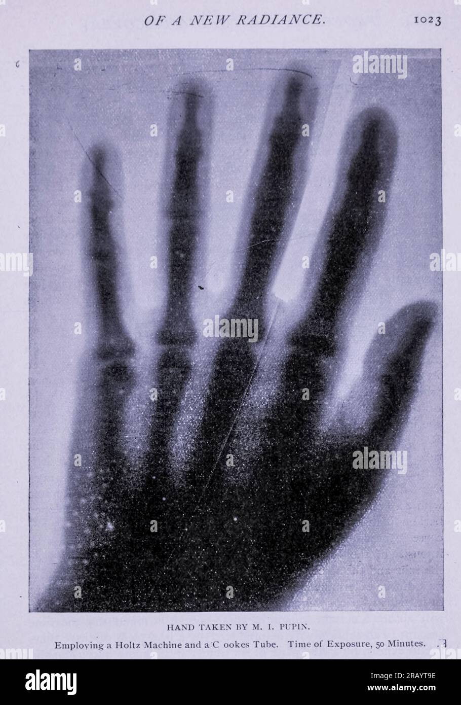 Rontgen hand hi-res stock photography and images - Alamy